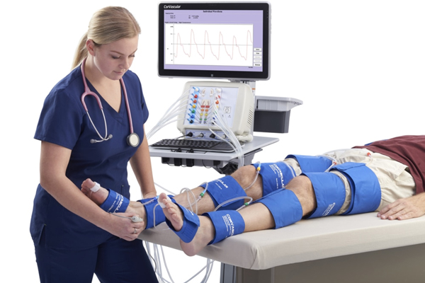 Pulse Volume Recording (PVR)